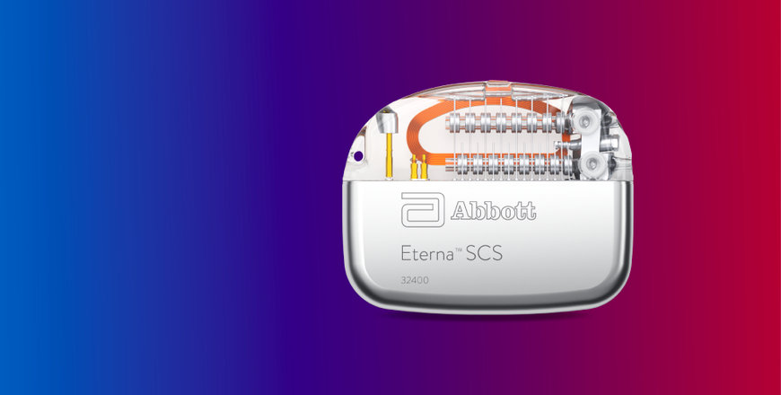 FDA APPROVES EXPANDED MRI LABELLING FOR ABBOTT'S ETERNA SCS SYSTEM | Medical Devices Technologies